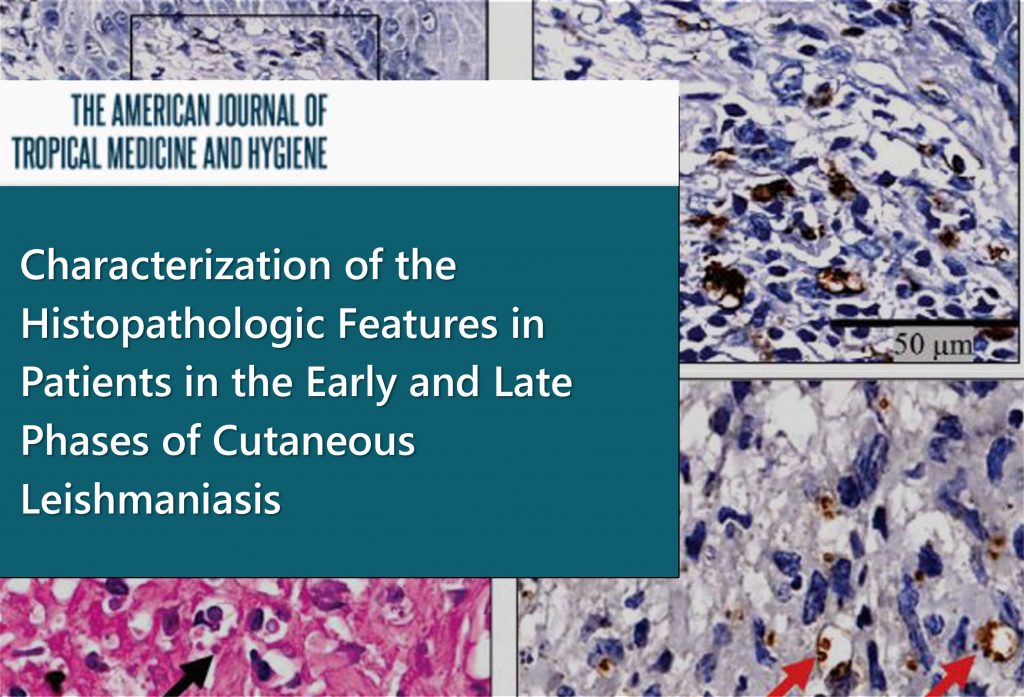 leishmania amastigota – Instituto Gonçalo Moniz